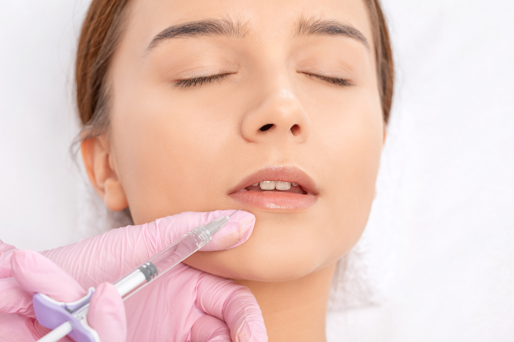 Can I Exercise After Lip Filler Dr Yousefi can-i-exercise-after-lip-filler-dr-yousefi