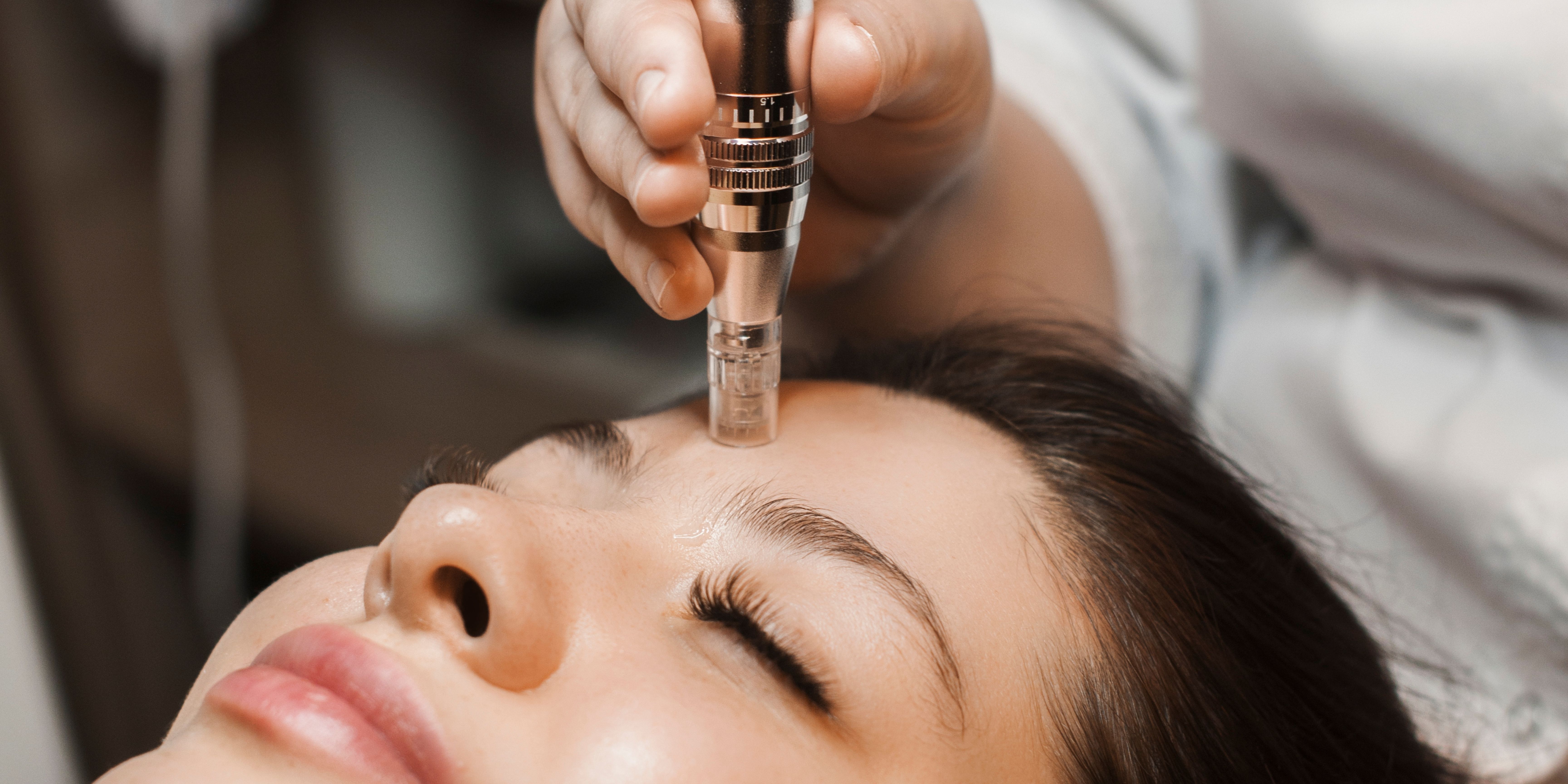 Microneedling Cost in Arlington Virginia - Dr Yousefi