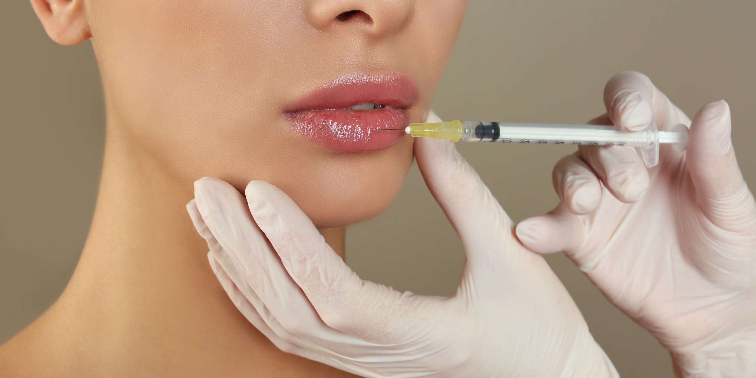 How Long Does Filler Last in Lips? - Dr Yousefi