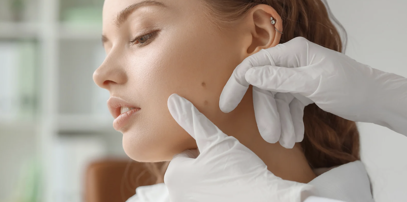 Finding the Top Dermatologist in VA - Dr Yousefi
