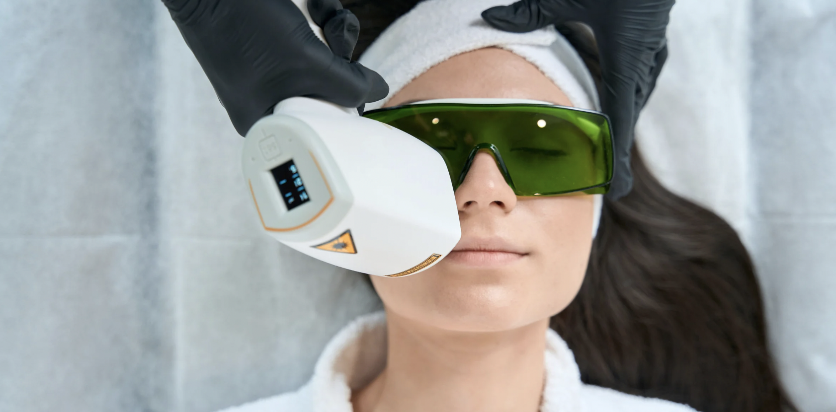 Dark Spot Reduction Treatment in McLean - Dr Yousefi