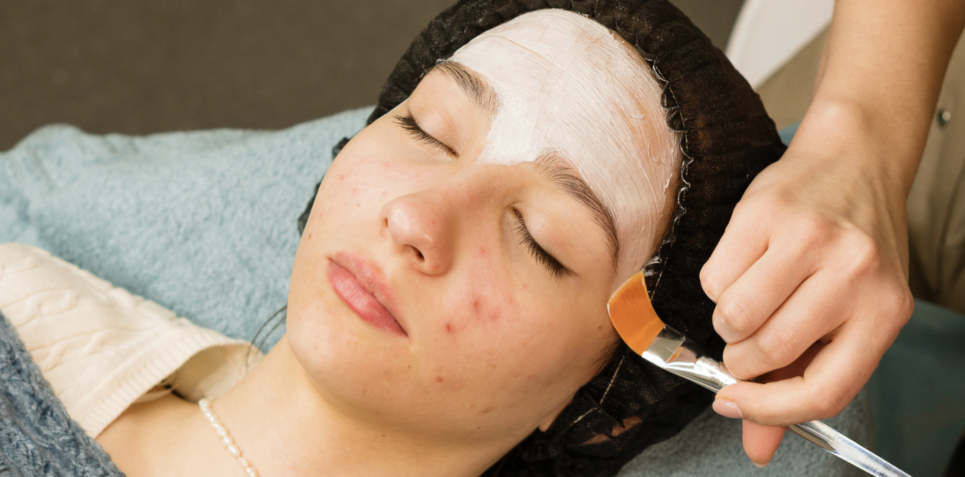 Quick Acne Treatment Options in Loudon County - Dr Yousefi