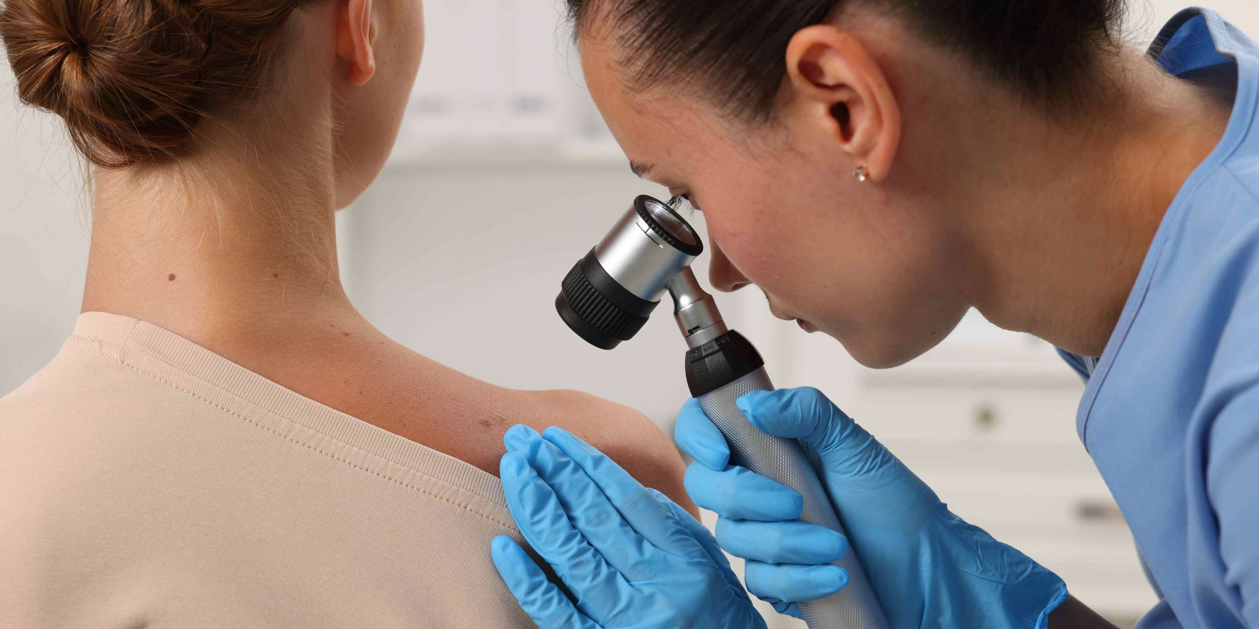 Dermatology Consultation for Mole and Skin Cancer Screening Near McLean ...