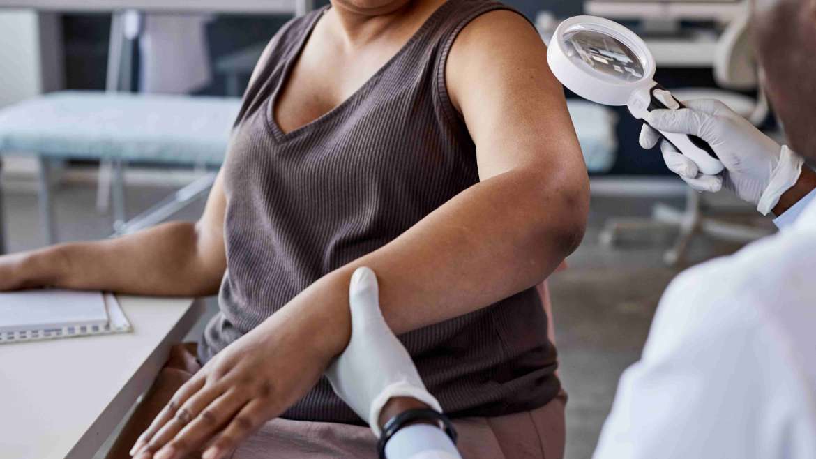 Skin Cancer Screening Dermatologist Near Reston, Virginia - Dr Yousefi