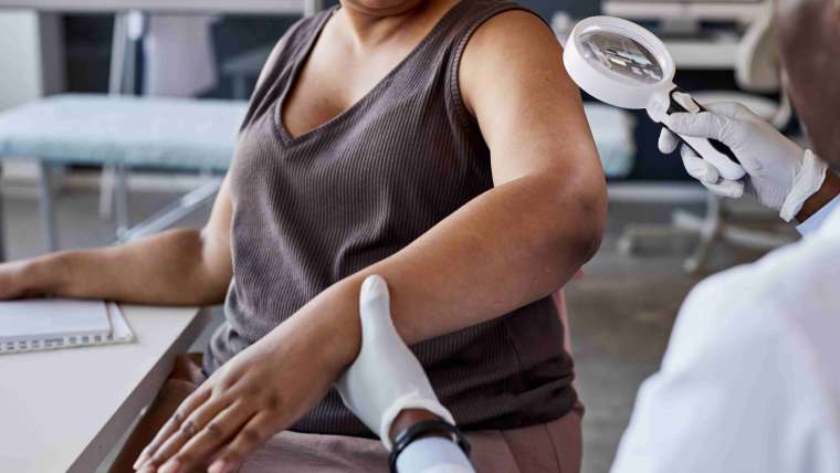 Skin Cancer Screening Dermatologist Near Reston, Virginia - Dr Yousefi