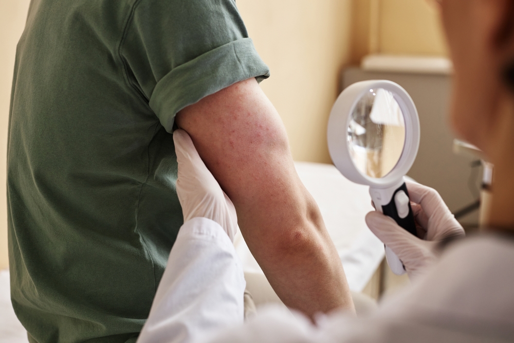 Psoriasis Specialist Near Falls Church, Virginia | Best Treatment Options